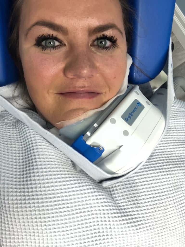 Freeze Away Your Double Chin | La Belle Vie | Draper, Utah