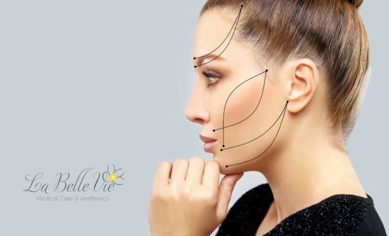 All About Facial Threads and How they Work | La Belle Vie, Draper